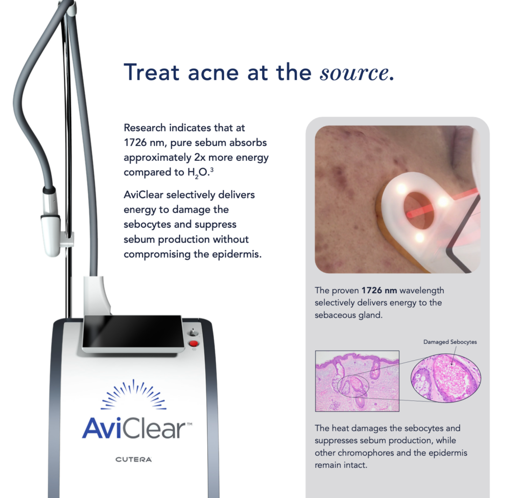Aviclear Laser Melbourne | Northside Dermatology